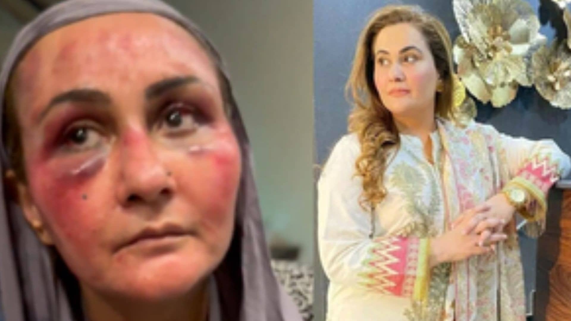 बाल घसीटे, बंदूक से मारा...पार की जुल्म की सारी हदें, PAK एक्ट्रेस ने ...