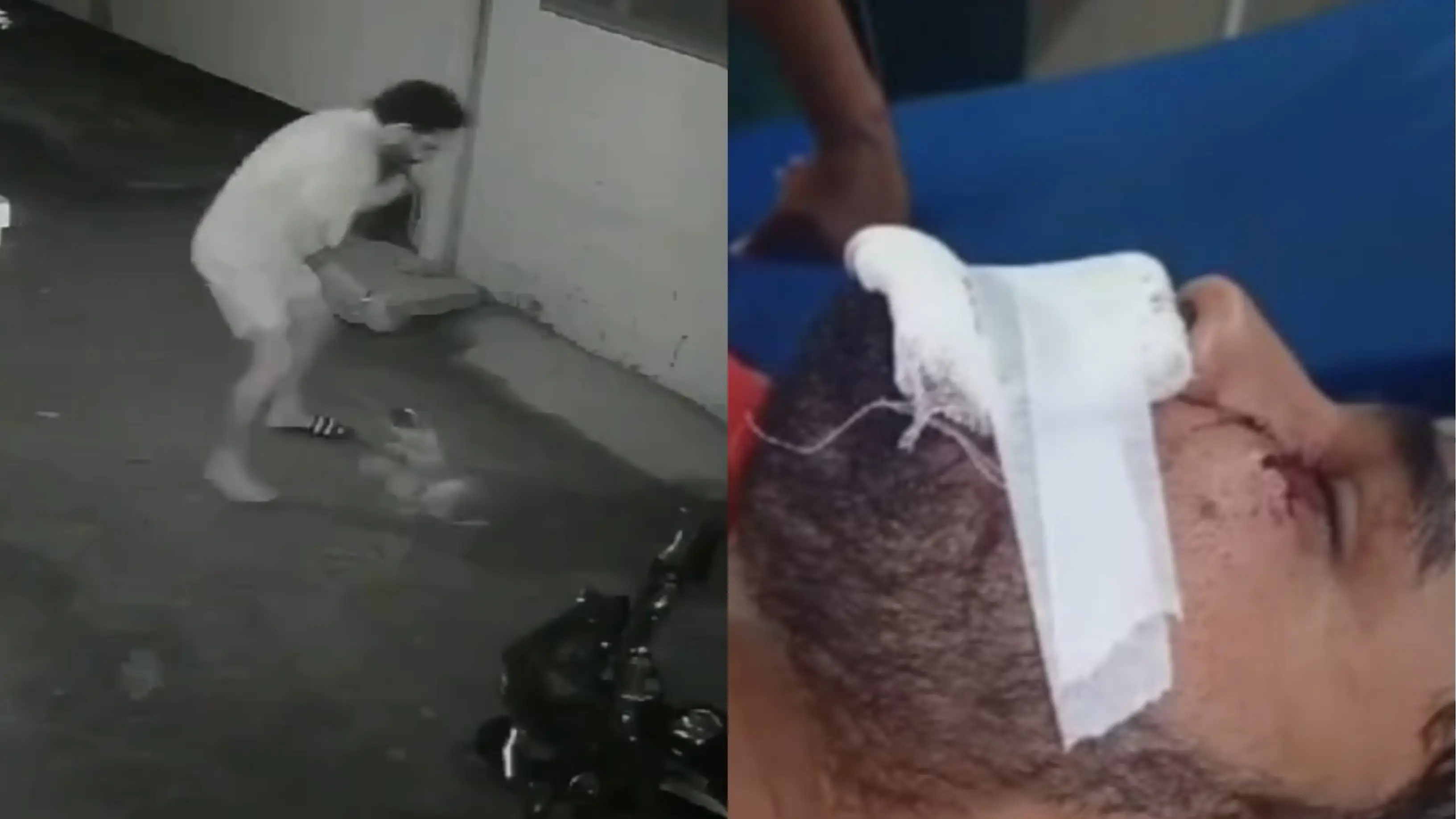 Stray Dog Attacks Young Man's Face in Gorakhpur, CCTV Video Goes Viral ...