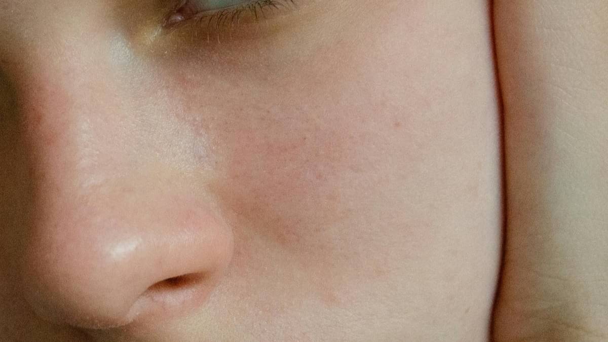 What Happens To Your Skin A Week After On Makeup Break? Things You Need ...