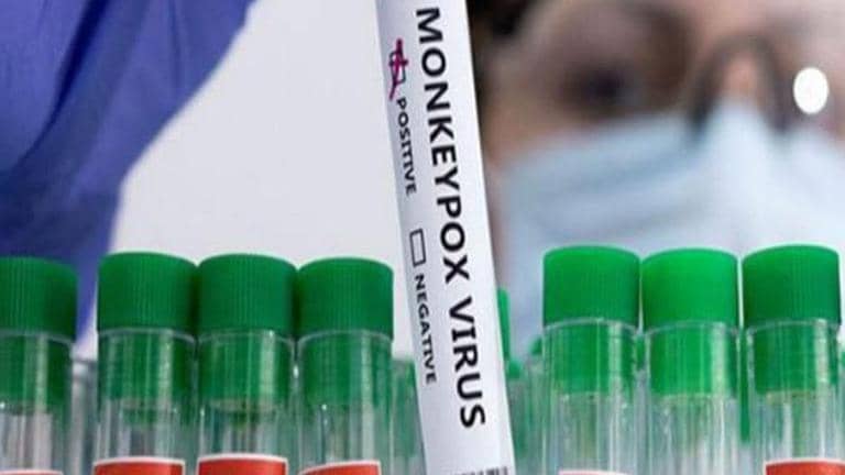 Monkeypox in India: Oral, nasal samples necessary for monkeypox ...