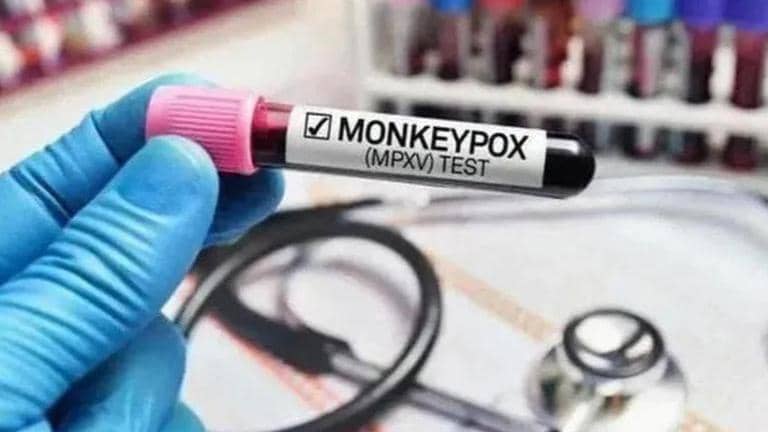 Sixth monkeypox case: Patient in stable condition at LNJP Hospital ...