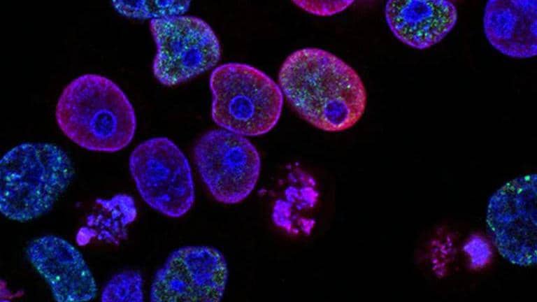 New study reveals therapeutic target for several types of aggressive ...