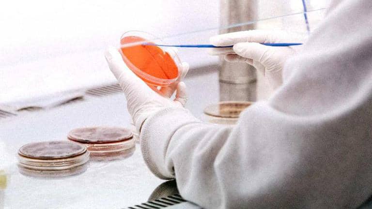 Now, China sees deadly anthrax pneumonia case, patient had cattle ...