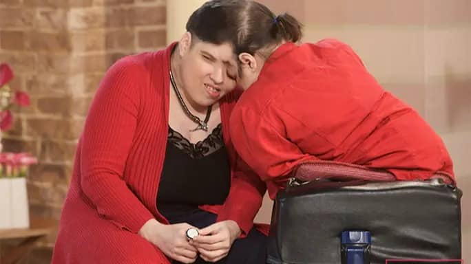 Oldest Living Conjoined Twins, Lori and George Schappell, Pass Away at ...