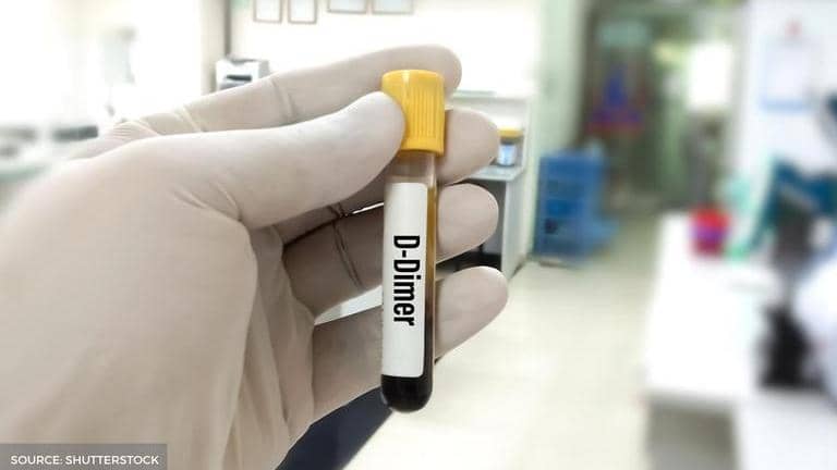 D-dimer Test: Find out what is the normal range of this protein in our ...